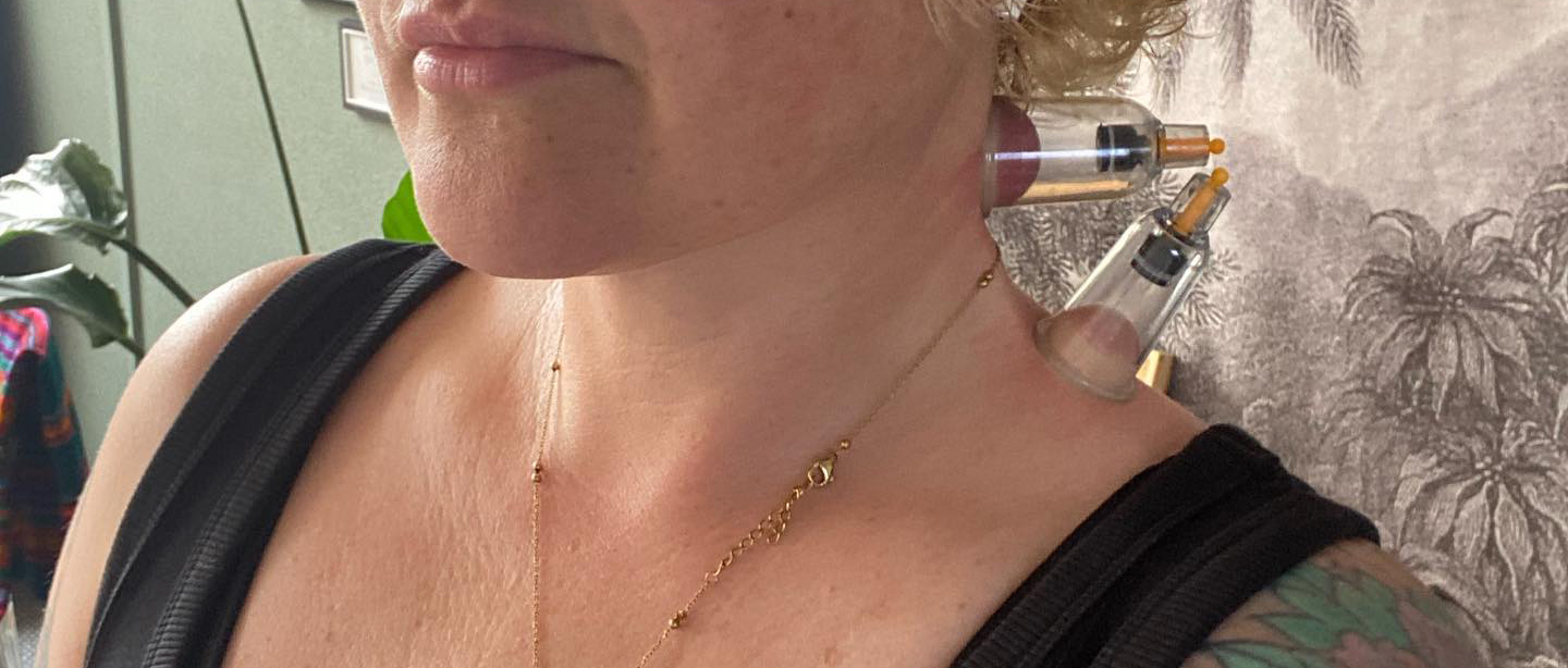 How can Cupping therapy help you? | The Botanical Apothecary